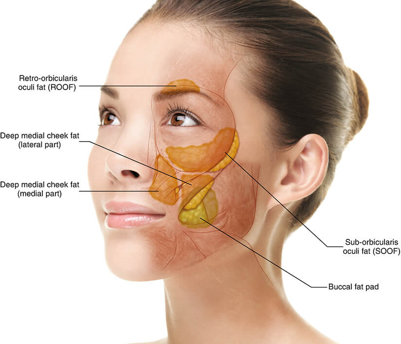 Buccal Fat Everything You Should Know About This Procedure
